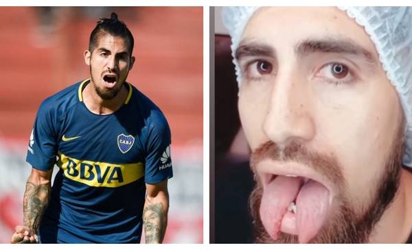 La impactante operación que se hizo el ex Boca Junior Benítez: qué es ...