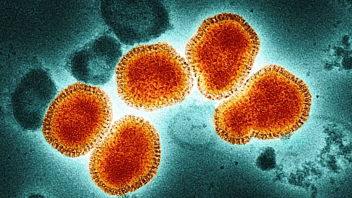 Alerta por una nueva SUPER GRIPE K que ya preocupa a Europa: síntomas ...